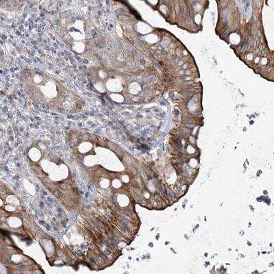 SCN11A Antibody (NBP1-82600): Novus Biologicals