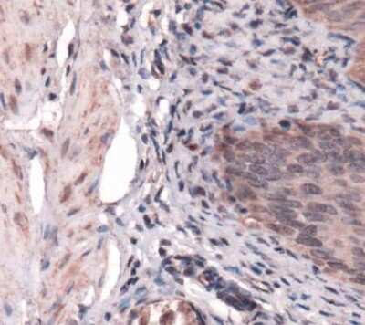 SDHB Antibody - BSA Free (NBP1-54154): Novus Biologicals