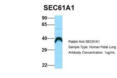 SEC61A Antibody (NBP2-86797): Novus Biologicals