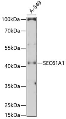 SEC61A Antibody (NBP2-94505): Novus Biologicals