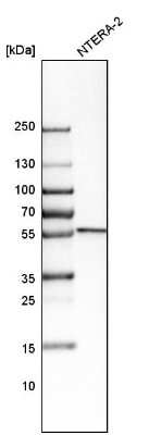 SERBP1 Antibody (NBP1-85660): Novus Biologicals