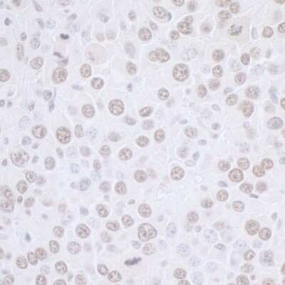 SET Antibody (NBP1-26646): Novus Biologicals