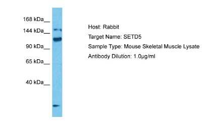 SETD5 Antibody (NBP2-85710): Novus Biologicals