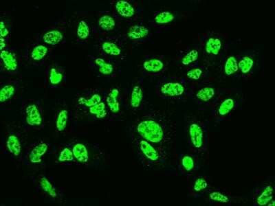 SF3B2 Antibody (NBP2-97657): Novus Biologicals
