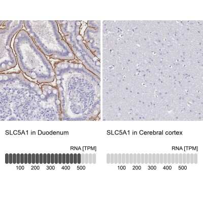 SGLT1/SLC5A1 Antibody (NBP2-33629): Novus Biologicals