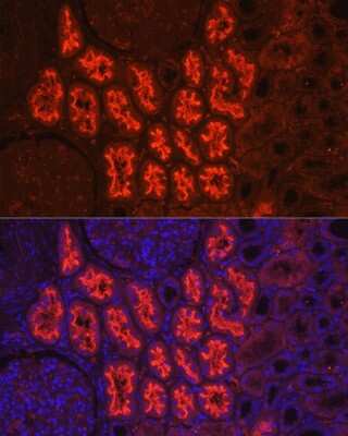 SGLT2/SLC5A2 Antibody (NBP3-15989): Novus Biologicals