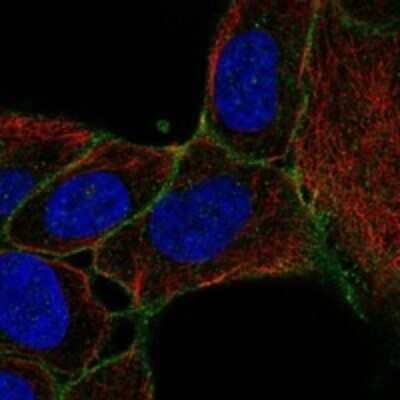 SLC14A1 Antibody (NBP3-17770): Novus Biologicals