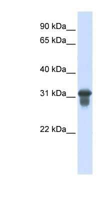 SLC25A11 Antibody (NBP1-59597): Novus Biologicals