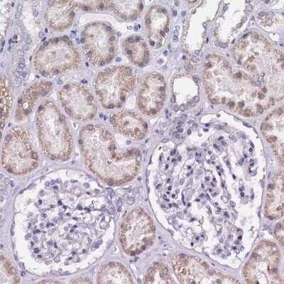 SLC37A4 Antibody (NBP2-31973): Novus Biologicals