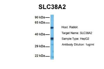 SLC38A2 Antibodies: Novus Biologicals