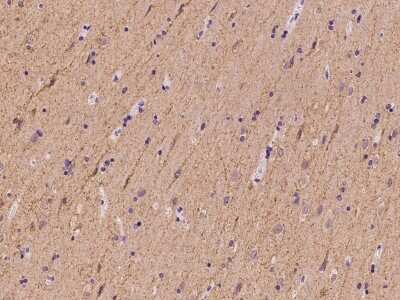 SLC4A10 Antibody (NBP2-98632): Novus Biologicals