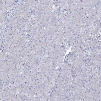 SLC6A19 Antibody (NBP1-86277): Novus Biologicals