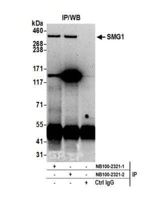 SMG1 Antibody (NB100-2321): Novus Biologicals