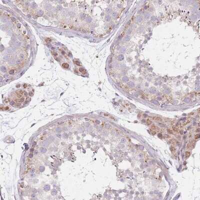 SMPD4 Antibody (NBP2-33567): Novus Biologicals