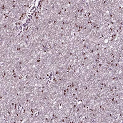 SOX10 Antibody (NBP2-57023): Novus Biologicals