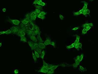 SSR3 Antibody (NBP2-97569): Novus Biologicals