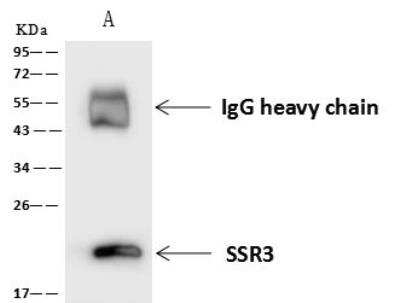 SSR3 Antibody (NBP2-97569): Novus Biologicals