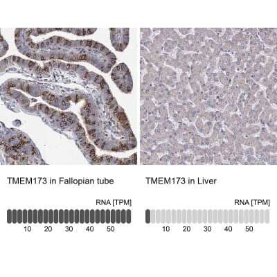 STING/TMEM173 Antibody (NBP2-48684): Novus Biologicals