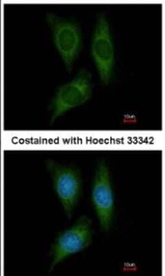 STK25 Antibody (NBP1-32670): Novus Biologicals