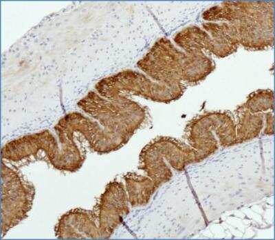 SUCNR1/GPR91 Antibody - BSA Free (NBP1-00861): Novus Biologicals