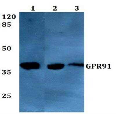 SUCNR1/GPR91 Antibody - BSA Free (NBP1-00861): Novus Biologicals