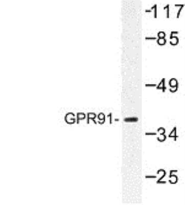 SUCNR1/GPR91 Antibody - BSA Free (NBP1-00861): Novus Biologicals