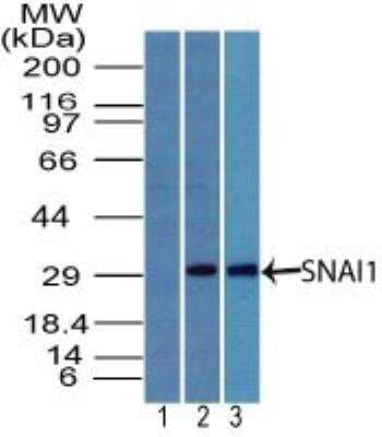 Snail Antibody (NBP2-27184): Novus Biologicals