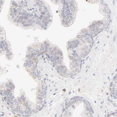 Spectrin beta 1 Antibody (NBP1-87596): Novus Biologicals