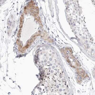 Stabilin-2 Antibody (NBP1-84197): Novus Biologicals