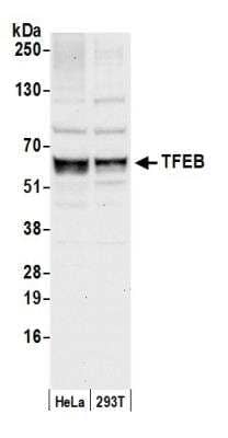 TFEB Antibodies: Novus Biologicals