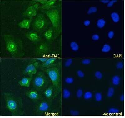 TIA1 Antibody (NB100-60555): Novus Biologicals