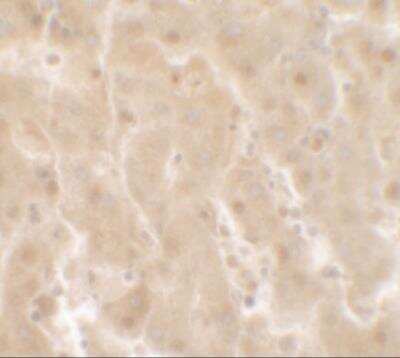 TIF1 gamma Antibody - BSA Free (NBP2-81762): Novus Biologicals