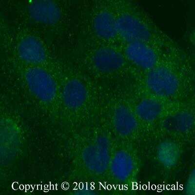 TIM-1/KIM-1/HAVCR Antibodies: Novus Biologicals