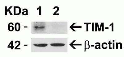 TIM-1/KIM-1/HAVCR Antibody - BSA Free (NBP1-76701): Novus Biologicals