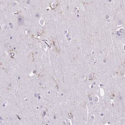 TMEM119 Antibody (NBP2-30551): Novus Biologicals