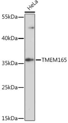 TMEM165 Antibody (NBP3-15530): Novus Biologicals