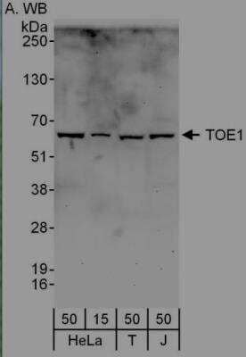 TOE1 Antibody (NBP2-04022): Novus Biologicals