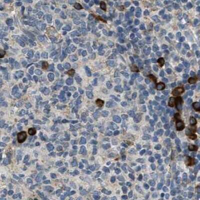 TRAP alpha Antibody (NBP1-87815): Novus Biologicals