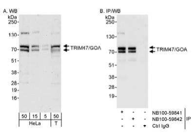 TRIM47 Antibody (NB100-59841): Novus Biologicals