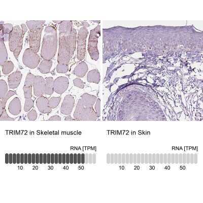 TRIM72 Antibody (NBP2-49157): Novus Biologicals