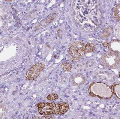 TROP-2 Antibody (NBP2-49166): Novus Biologicals