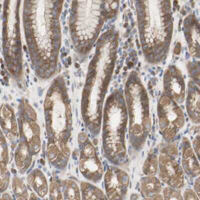 TTMP Antibody (NBP1-93934): Novus Biologicals