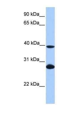 UBE2F/NCE2 Antibody (NBP1-57602): Novus Biologicals