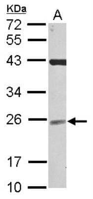 UBE2F/NCE2 Antibody (NBP2-19485): Novus Biologicals