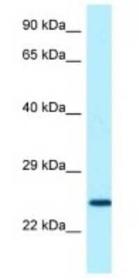 USAG1/SOSTDC1 Antibody (NBP1-98525): Novus Biologicals