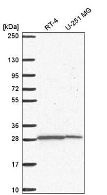 Uridine Phosphorylase 1/UPP1 Antibody (NBP2-58229): Novus Biologicals