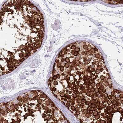 VASA Antibody (NBP2-13908): Novus Biologicals