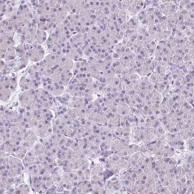 VIAAT/SLC32A1/VGAT Antibody (NBP2-34117): Novus Biologicals