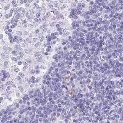 VIAAT/SLC32A1/VGAT Antibody (NBP2-34131): Novus Biologicals