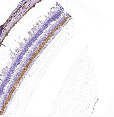 VIAAT/SLC32A1/VGAT Antibody (NBP2-34131): Novus Biologicals